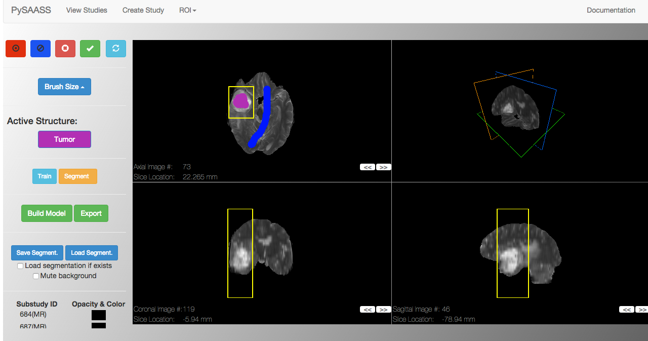 Liron Shimrony - Portfolio